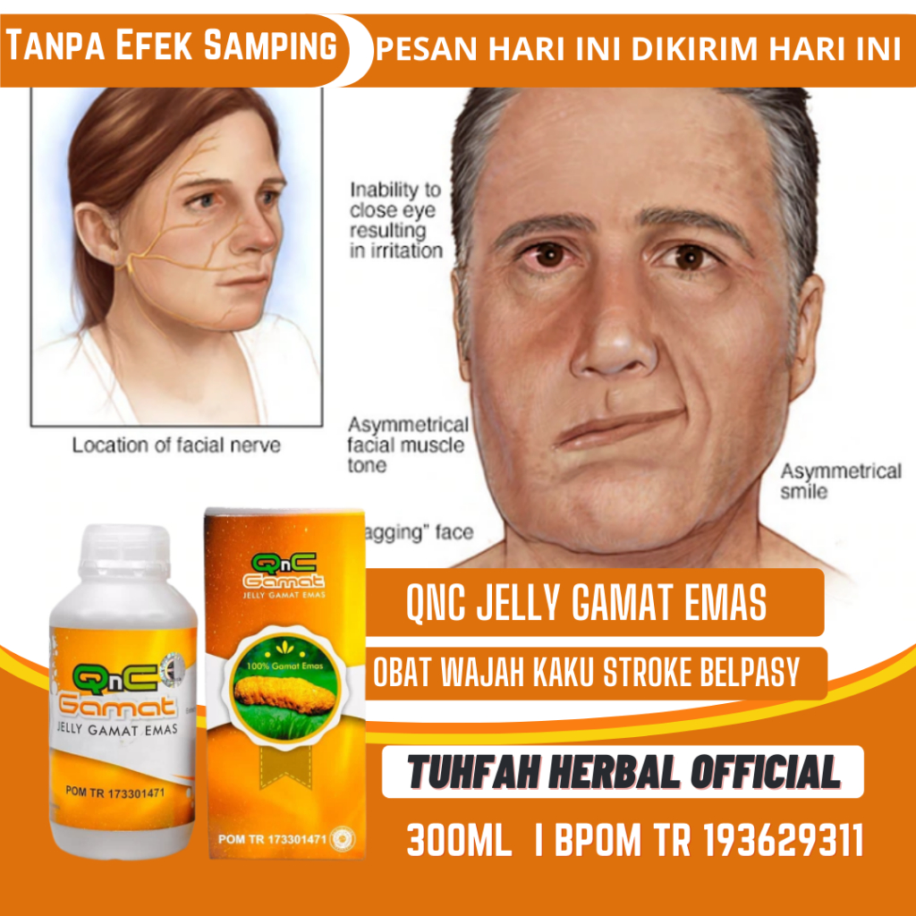 Jual Obat Susah Bicara Pelo, Syaraf Wajah Kaku, Obat Bells Palsy ...