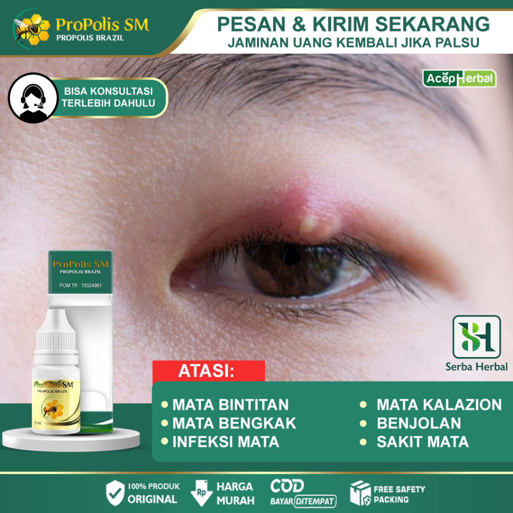 Jual Obat Mata Bintitan Obat Penghilang Mata Bintilan Luar Dalam ...