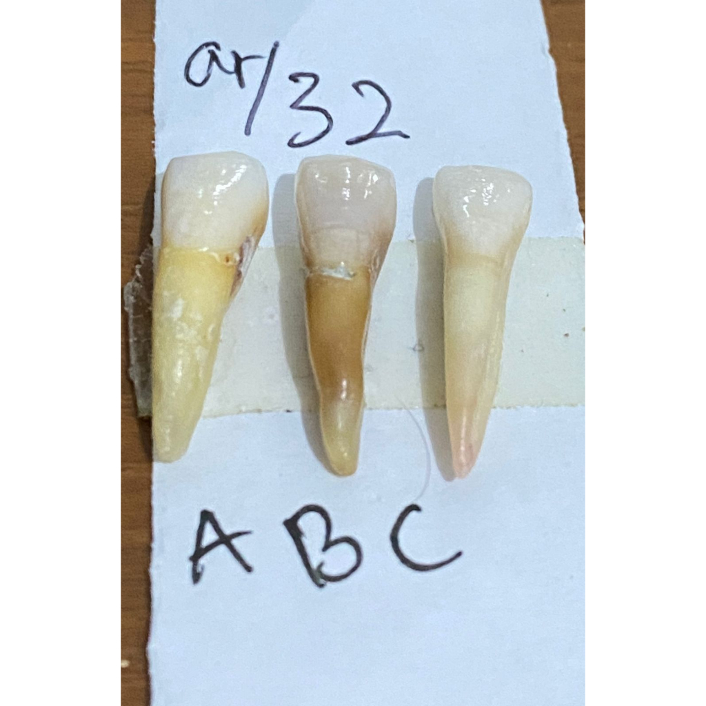 Jual INSISIVUS LATERAL RB (GIGI PRAKTIKUM FKG) | Shopee Indonesia