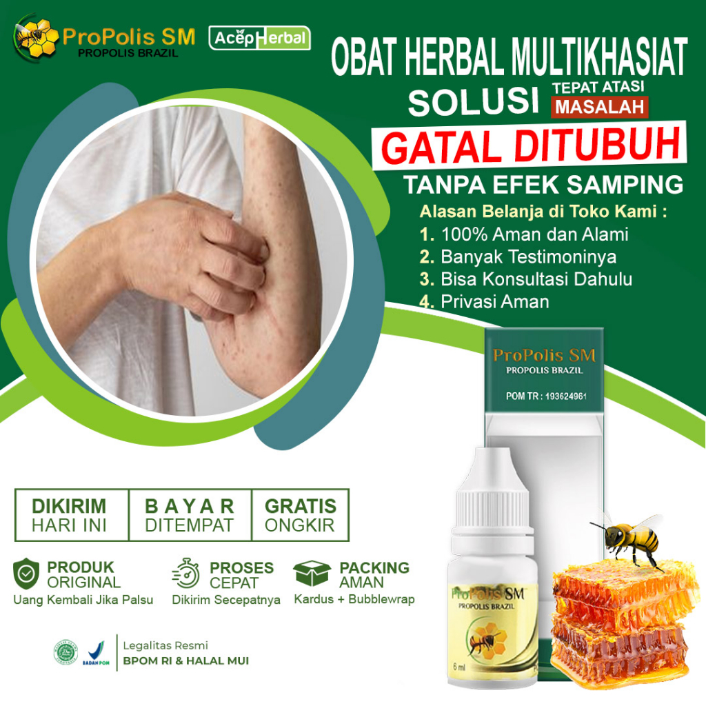 Jual Obat Gatal Alergi Biduran Gatal Obat Kaligata Bentol Kulit Gatal ...