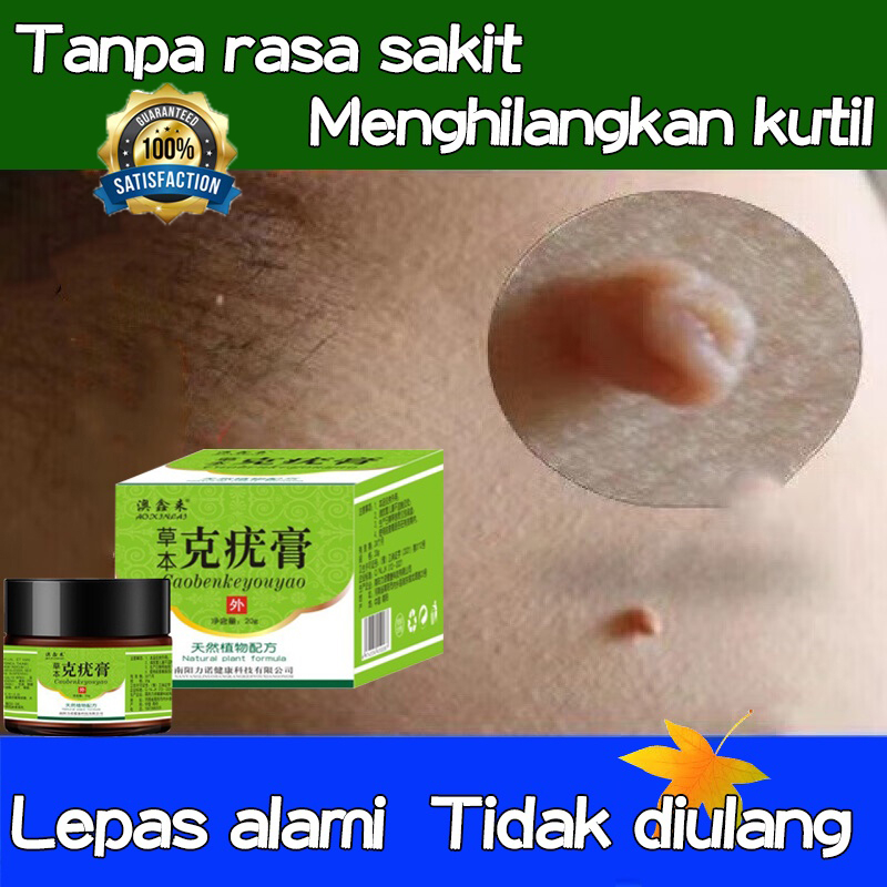 Jual Krim kutil obat penghilang kutil penghilang kutil 20g skin tag ...