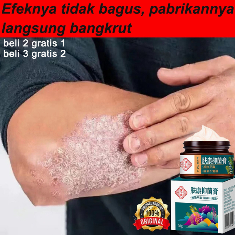 Jual salep eksim Krim Antipruritic Meredakan Peradangan Gatal Krim ...