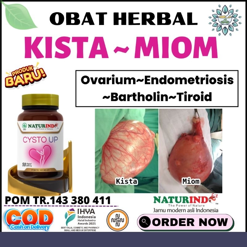Jual Obat Miom Myom Kista Ovarium Bartholin Kista Coklat Kista Tiroid ...