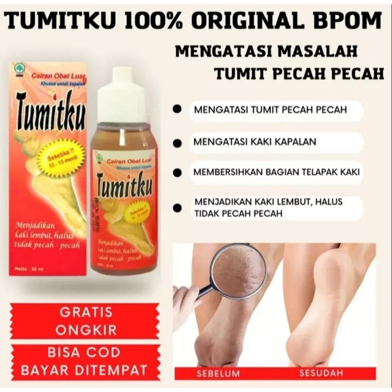 Jual TUMITKU OBAT KAKI PECAH BPOM ORIGINAL SOLUSI UNTUK TUMIT PECAH ...