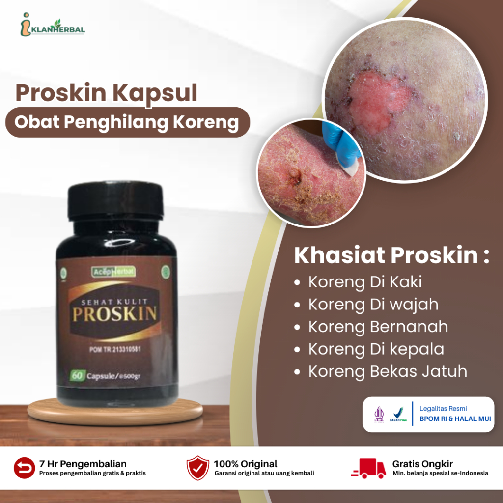 Jual Obat Luka Koreng Di Kaki, Luka Koreng di Wajah, Luka Koreng ...