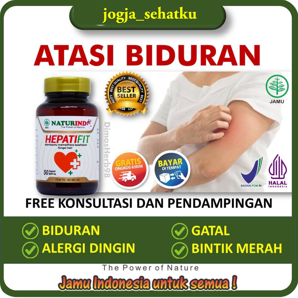 Jual Obat Biduran Alergi Kaligata Gatal Gatal Hepatifit Naturindo ...