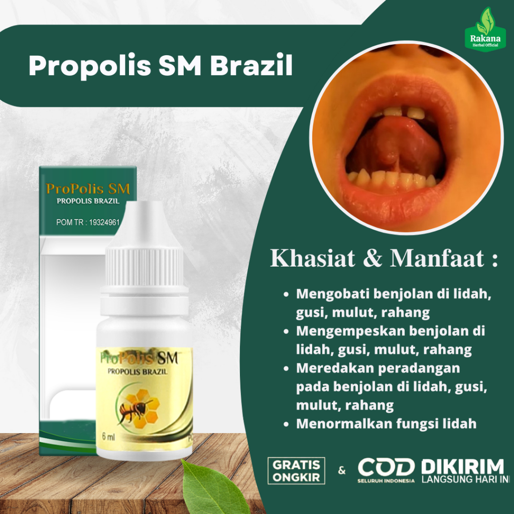 Jual PROPOLIS SM Obat Benjolan Di Bawah Lidah / Herbal Benjolan Di ...