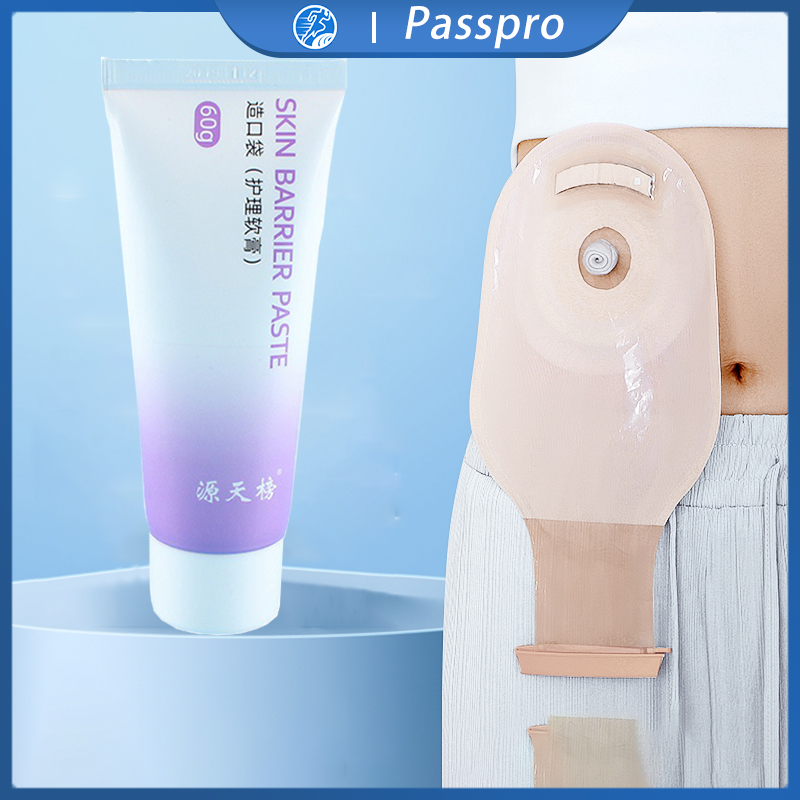 Jual 60g Pasta Kantong Kolostomi Lem Colostomy Bag Convatec Stomahesive ...