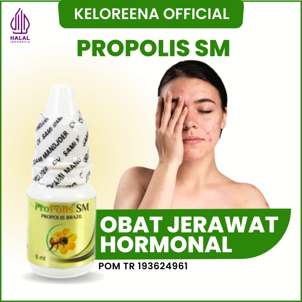 Jual Obat Jerawat Hormonal Oles Totol Kempes Kering Menghilangkan Bekas ...