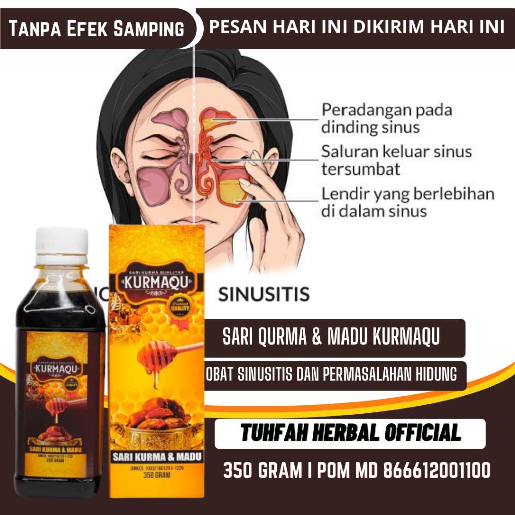 Jual Obat Sinusitis, Obat Sinus, Hidung Tersumbat, Pilek Menahun, Madu ...