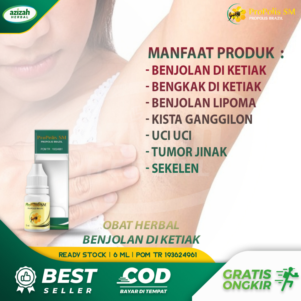 Jual Obat Benjolan Di Ketiak Kista Ganggilon Tumor Lipoma Uci Uci ...