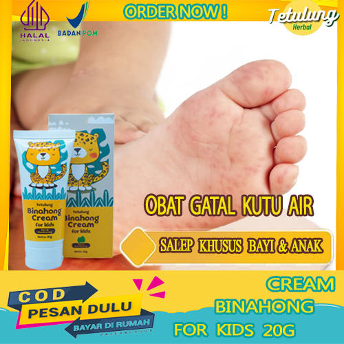Jual Salep Antigatal Kutu Air Anak, Salep Original Anak Ampuh Bintik ...
