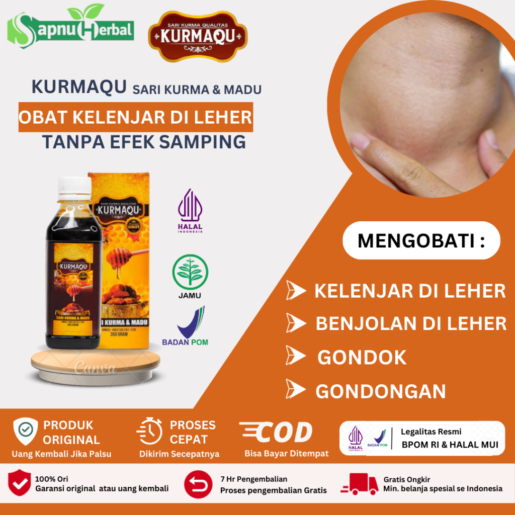 Jual Sapnu Herbal - Obat Kelenjar Tiroid di Leher, Gondok, Benjolan ...