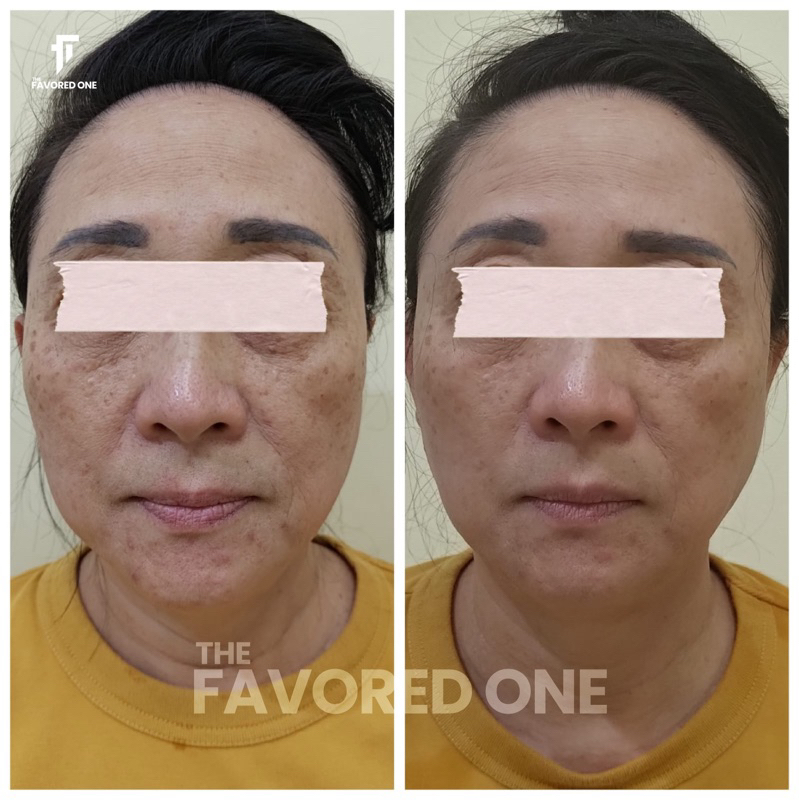 Jual Masker Viral BB Glow Botox Instant | Shopee Indonesia