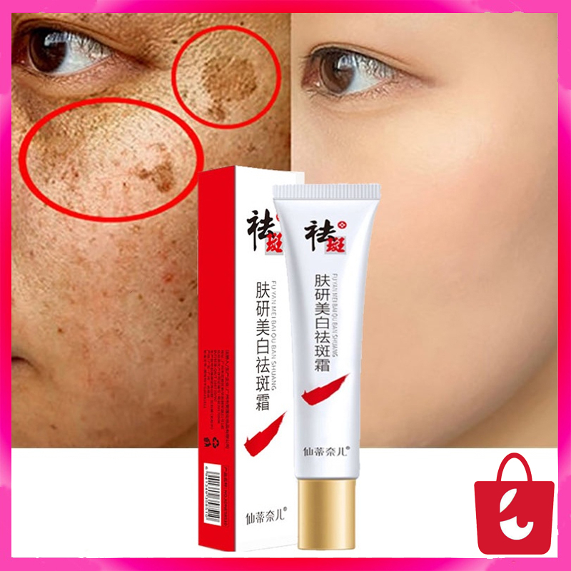 Jual CINDYNAL Whitening Freckle Cream Remove Penghilang Noda Kulit Krim Wajah Pemutih Krim ...