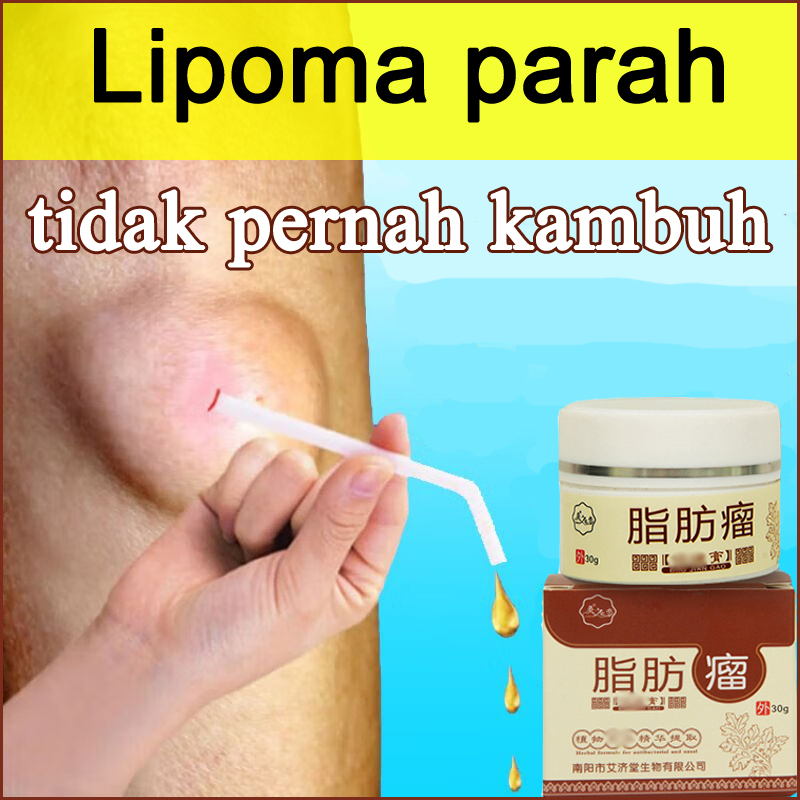 Jual Salep lipoma salep benjolan lipoma lipoma cream original 30g ...