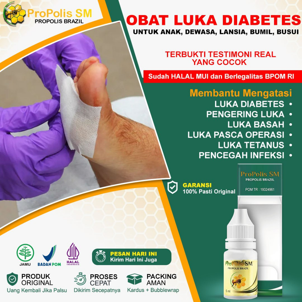 Jual Obat Luka Diabetes Basah Obat Luka Bernanah Gula Darah Obat ...