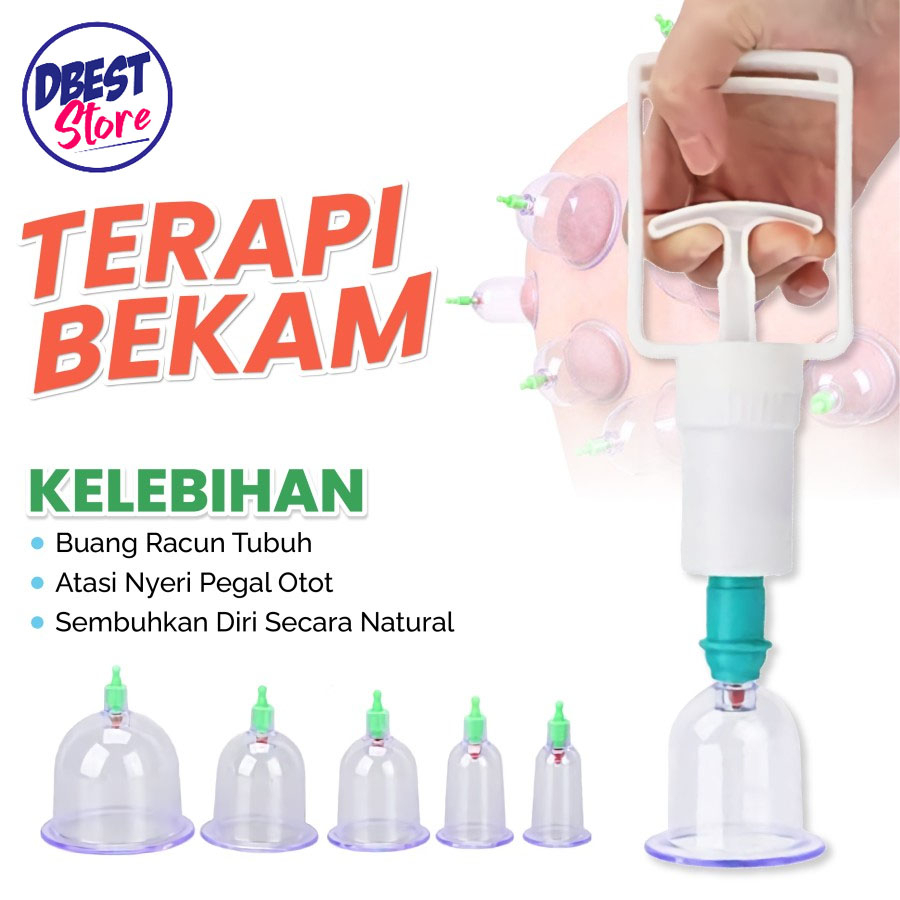 Jual Kop Angin Bekam Lengkap Isi 6 Cup Mengobati Masuk Angin dan Kesehatan Badan | Shopee Indonesia