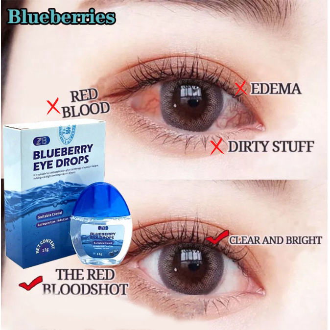 Jual Tetes Mata Softlens Tetes Mata Herbal Tetes Mengandung ekstrak ...