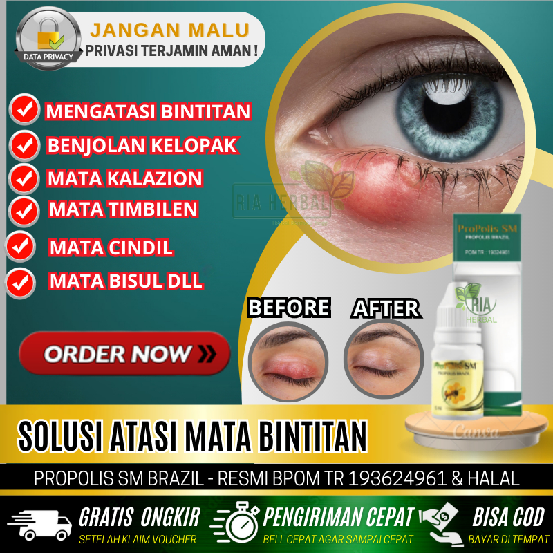 Jual Obat Oles Penghilang Benjolan di Kelopak Mata, Salep Pelenyap ...