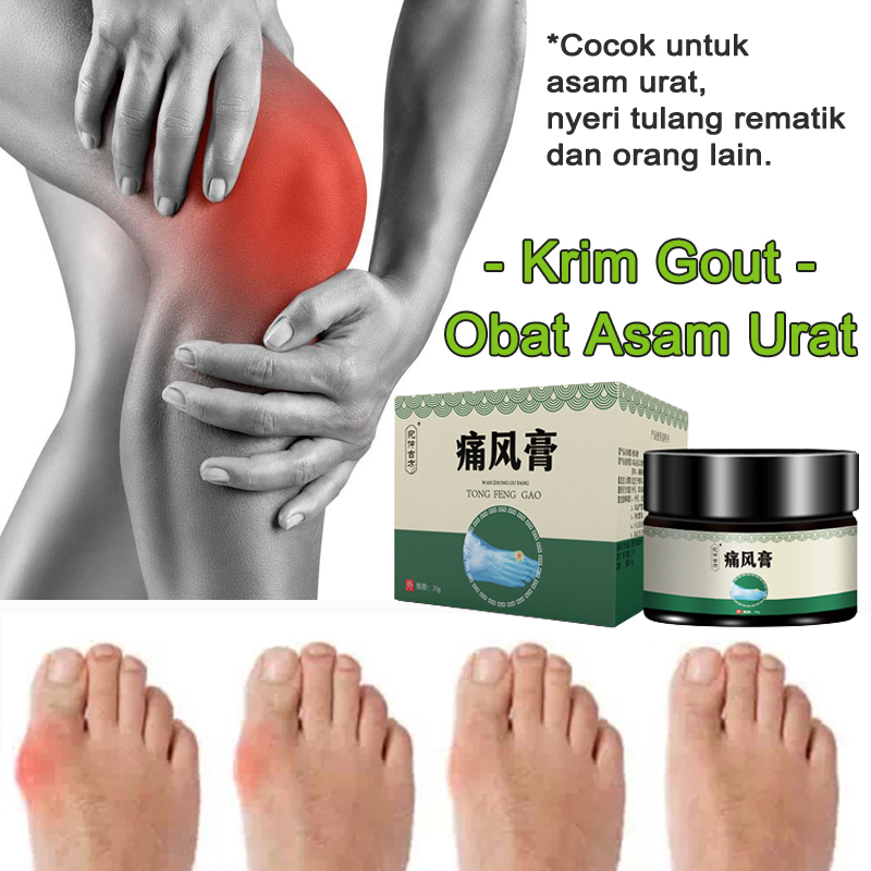 Jual Krim Gout Obat Asam Urat Pereda nyeri 35g Sakit pinggang Salep ...