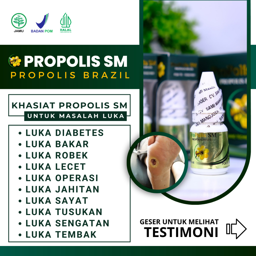Jual Obat Pengering Luka, Luka Diabetes Basah, Luka Bakar, Luka Bekas ...
