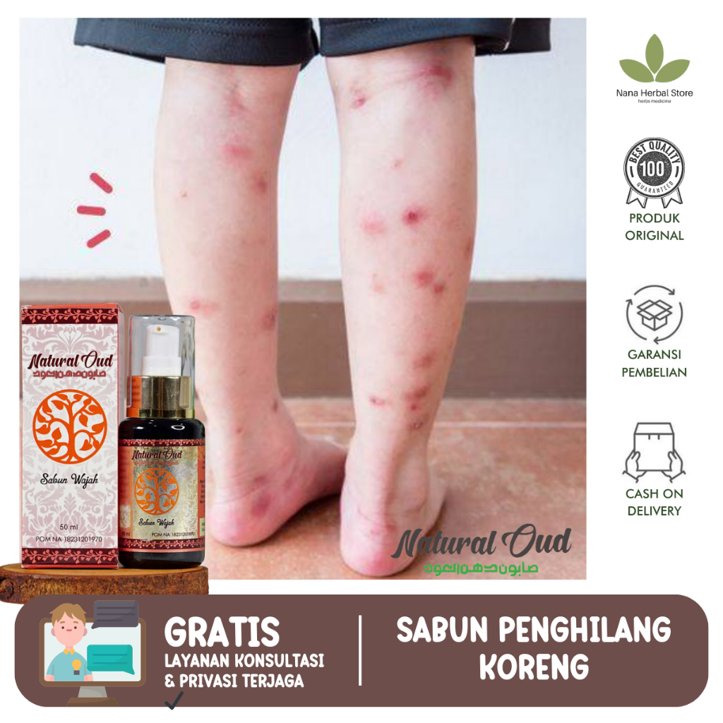 Jual Obat Koreng, Koreng Di Kaki, Penghilang Bekas Luka Koreng ...