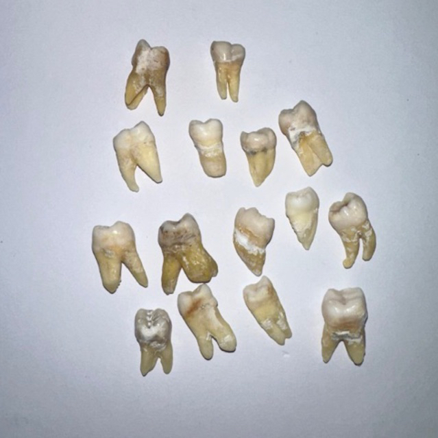 Jual gigi molar permanen asli | Shopee Indonesia