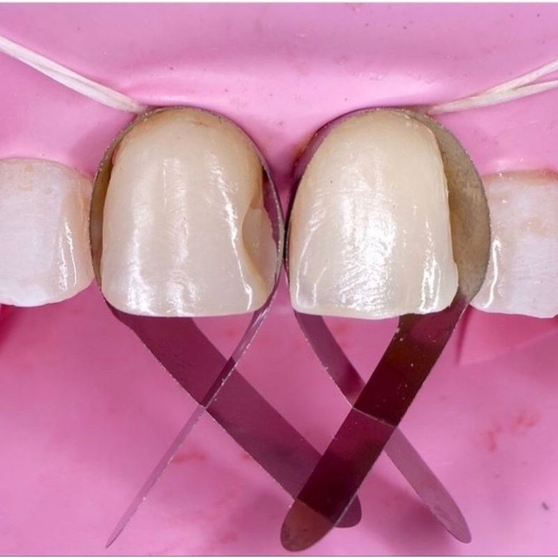 Jual ORIGINAL TOR VM Matrix Anterior Twin | Matrix Veneer | Unica ...