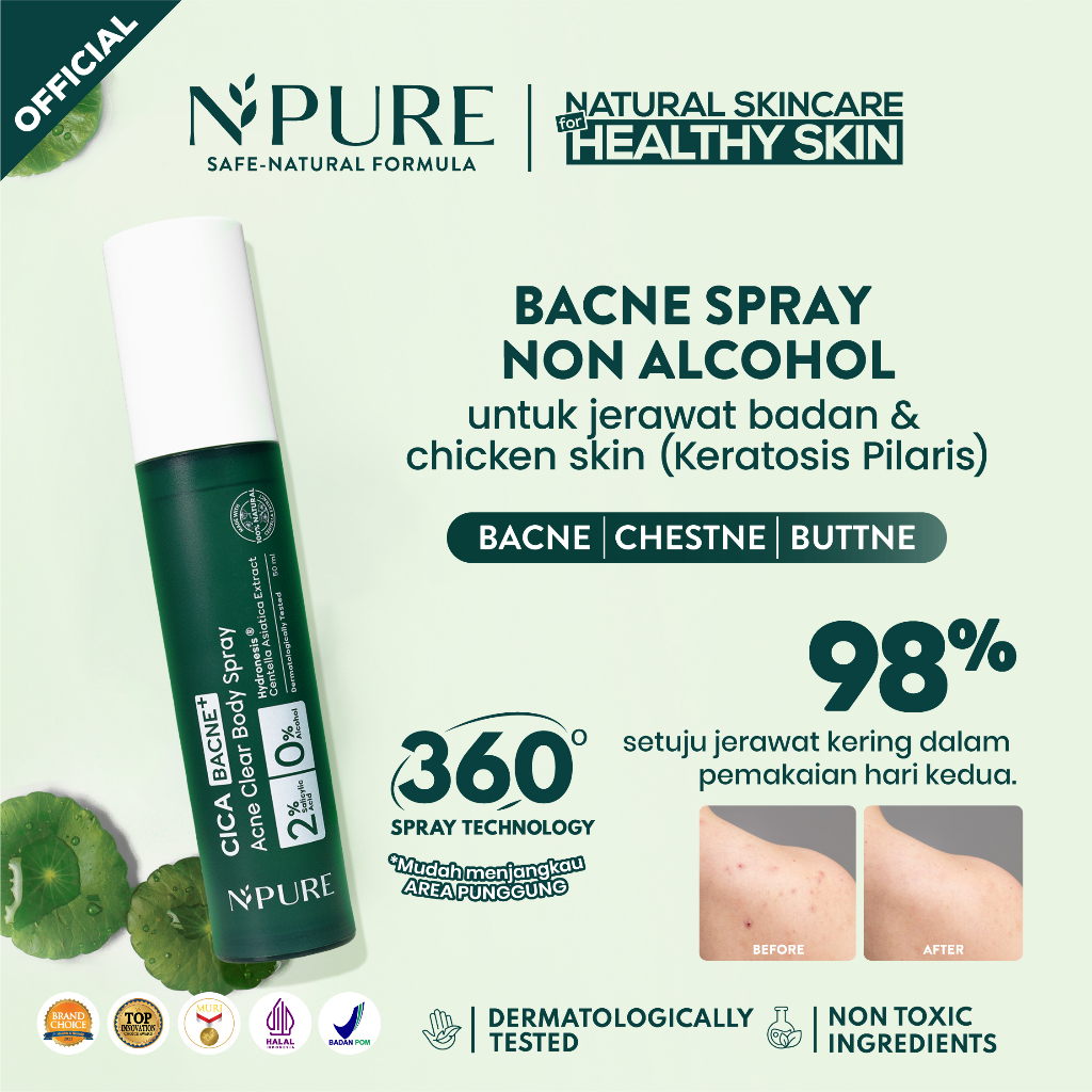 Jual NPURE Bacne Spray /Jerawat Punggung & Badan / Chicken Skin ...