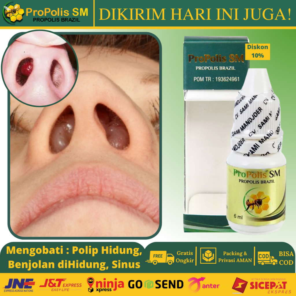 Jual Propolis Sm - Obat Polip Hidung, Salep Polip Hidung, Obat Benjolan Di Dalam Hidung, Obat ...