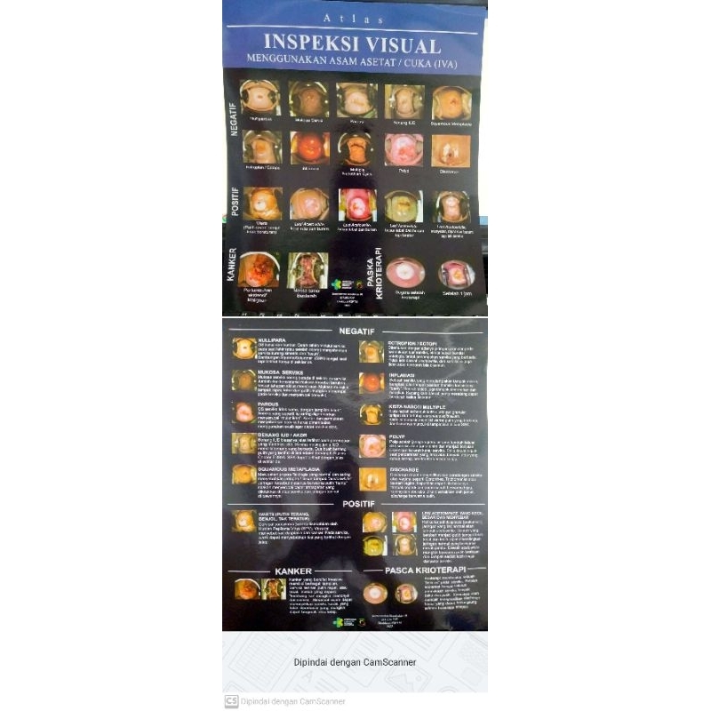 Jual inspeksi visual iva test | Shopee Indonesia