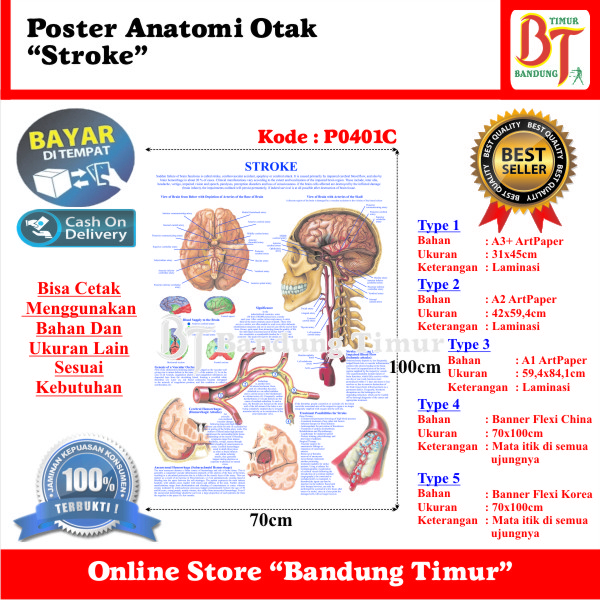 Jual POSTER ANATOMI OTAK STROKE | Shopee Indonesia