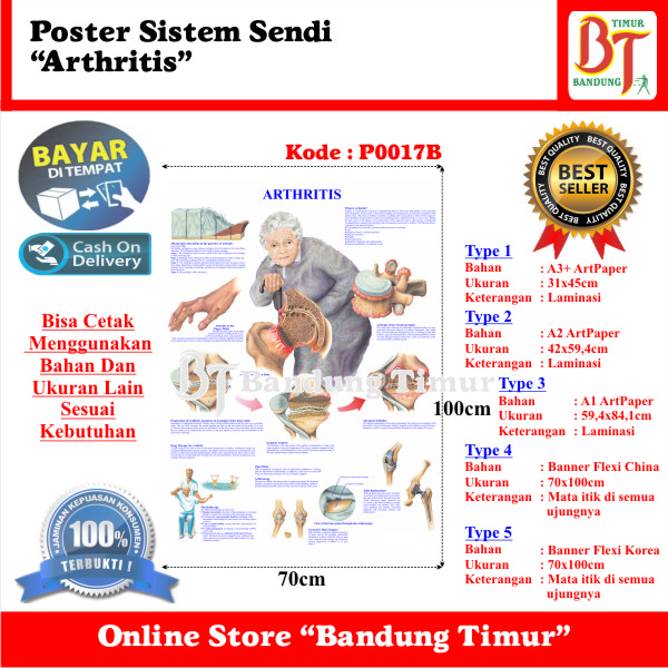 Jual POSTER SISTEM SENDI ARTHRITIS | Shopee Indonesia