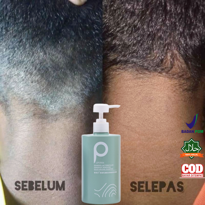 Jual [COD] Shampo anti ketombe Sampo anti ketombe anti ketombe Obat ketombe 500ml memperbaiki ...