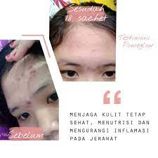 Jual POMEGLOW MINUMAN COLLAGEN BIKIN GLOWING | Shopee Indonesia