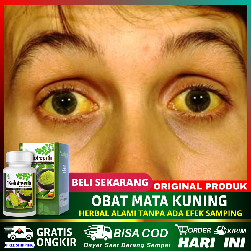 Jual Obat Mata Kuning Hepatitis Penyakit Liver Pemutih Mata Kuning ...