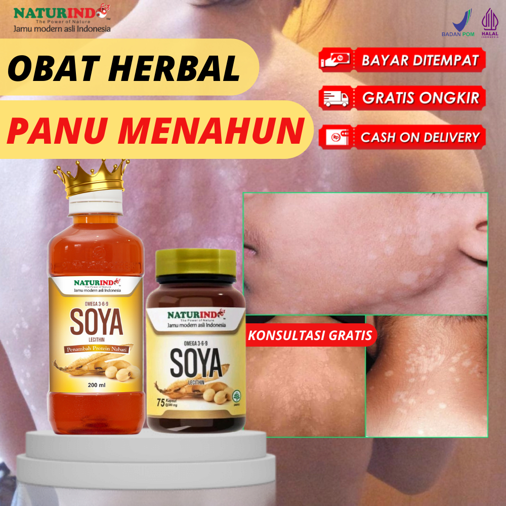 Jual Obat Panu Gatal Menahun Kadas Kurap Infeksi jamur Bintik Gatal ...