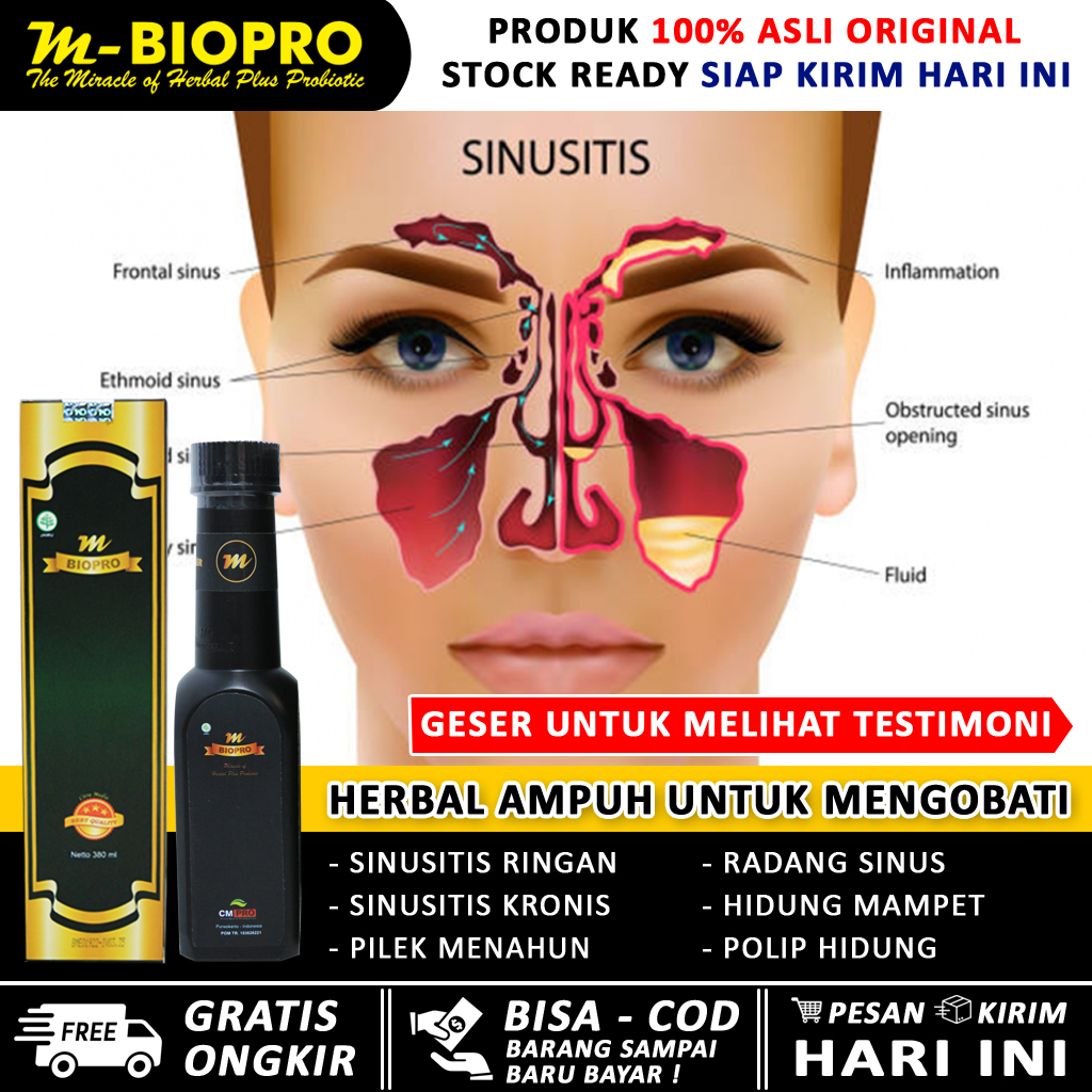 Jual Obat sinusitis paling ampuh - sinusitis hidung semprot - sinusitis ...