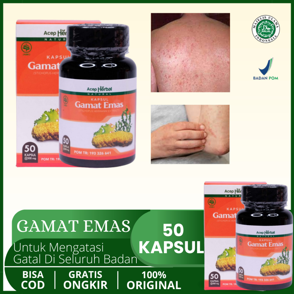 Jual Obat Gatal Menyebar Ke Seluruh Tubuh, Gatal Pada Bagian Kaki Dan ...