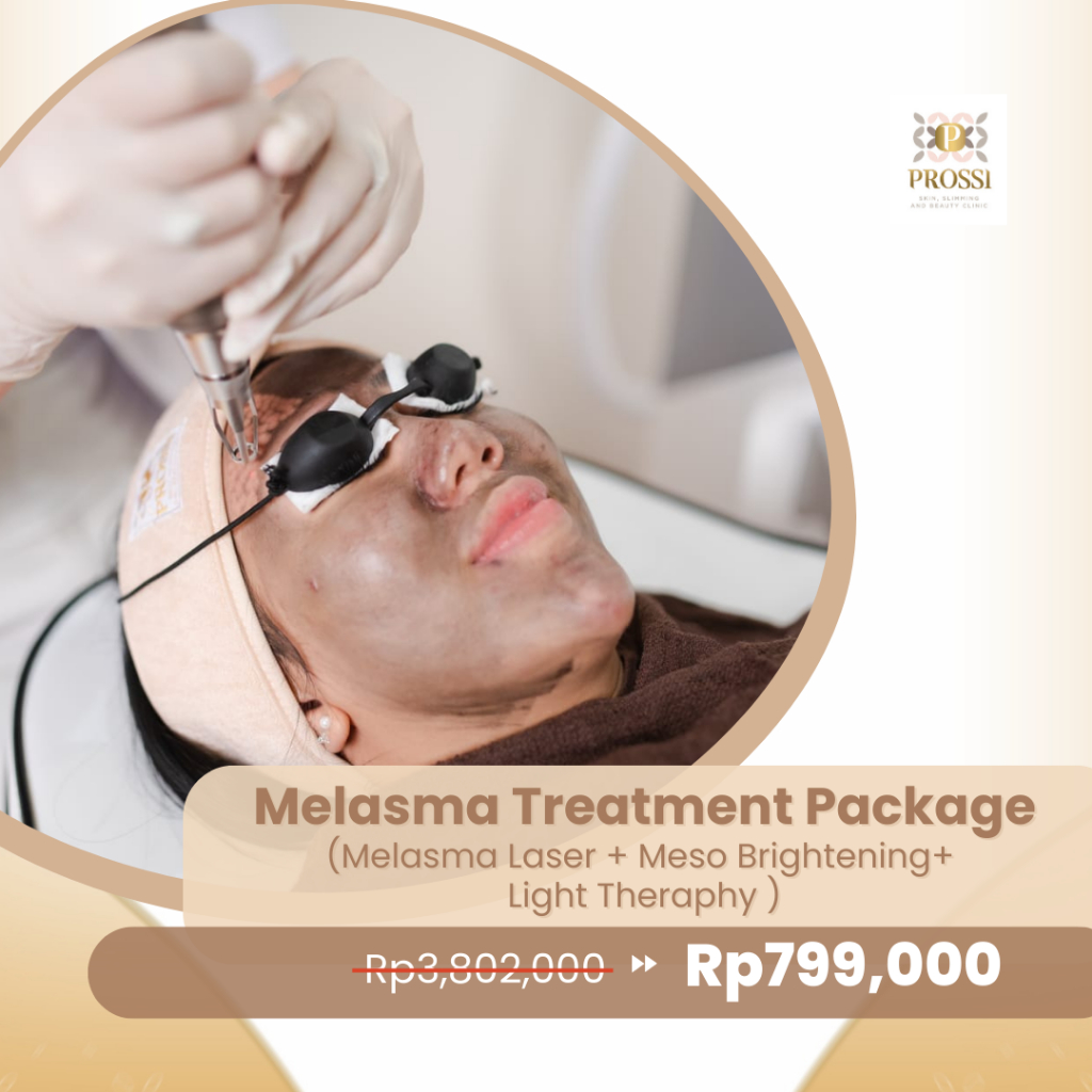Jual Melasma Treatment Package (Melasma Laser + Meso Brightening ...