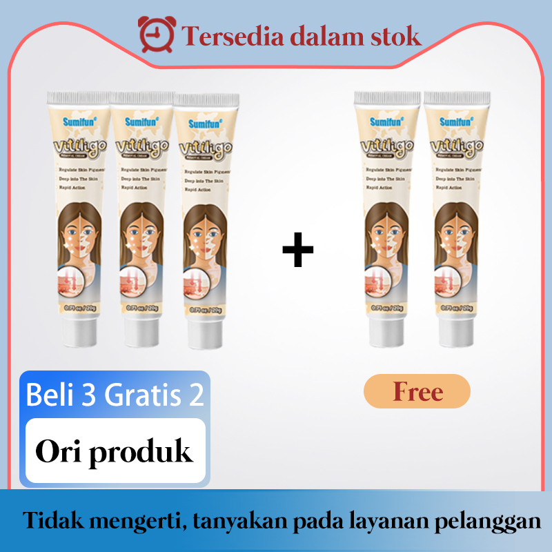 Jual Salep khusus untuk vitiligo 20g vitiligo/penyakit kulit putih/panu ...