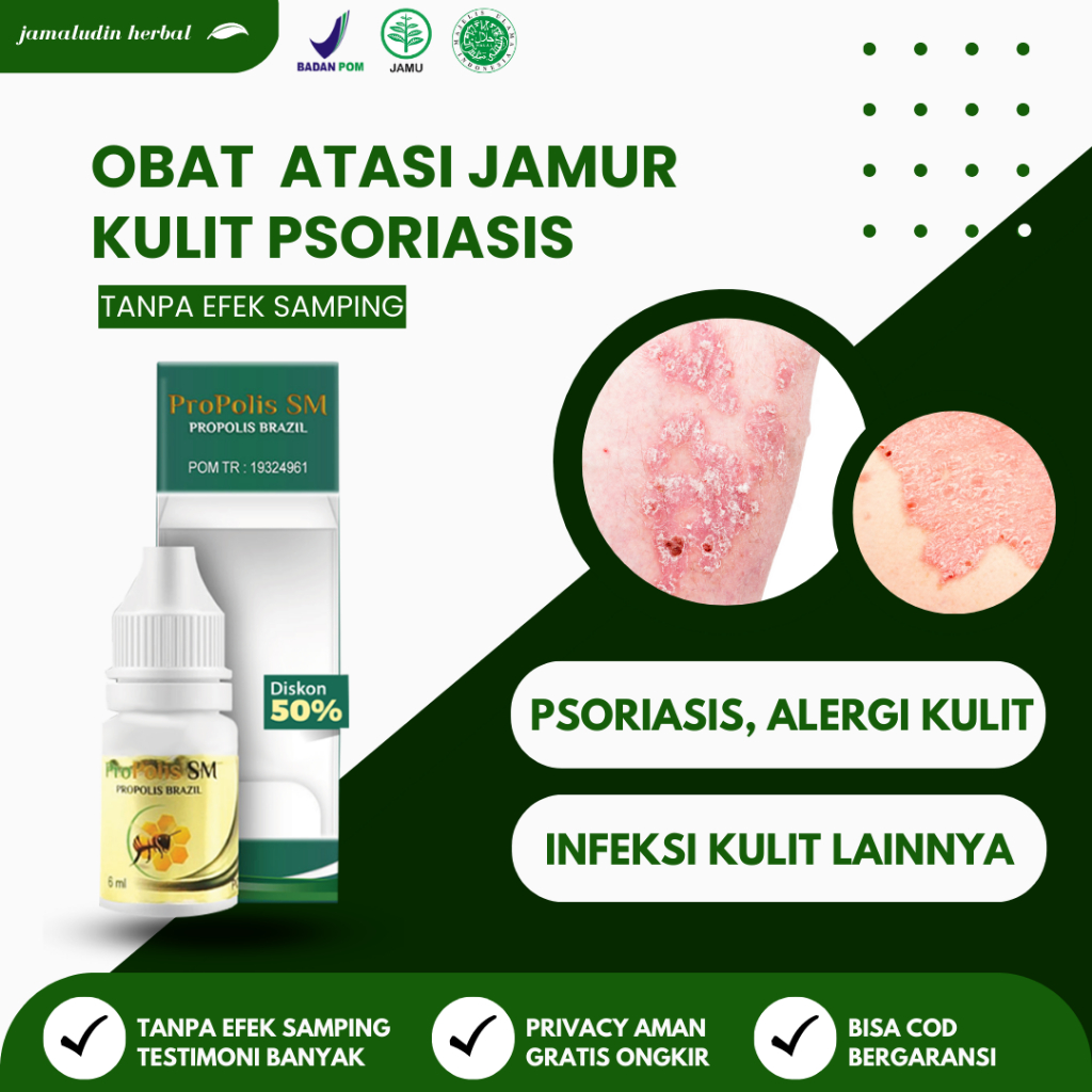 Jual Obat Gatal Kulit - Obat Koreng Di kaki - Obat Gatal Gatal Pada ...