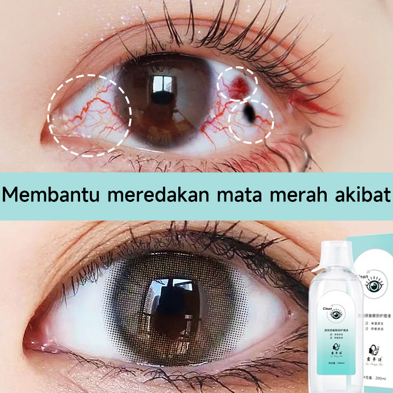 Jual 𝗢𝗯𝗮𝘁 𝗺𝗮𝘁𝗮 𝗣𝗲𝗺𝗯𝗲𝗿𝘀𝗶𝗵 𝗺𝗮𝘁𝗮 𝗘𝘆𝗲 𝗳𝗹𝘂𝘀𝗵 200ml Membersihkan mata ...