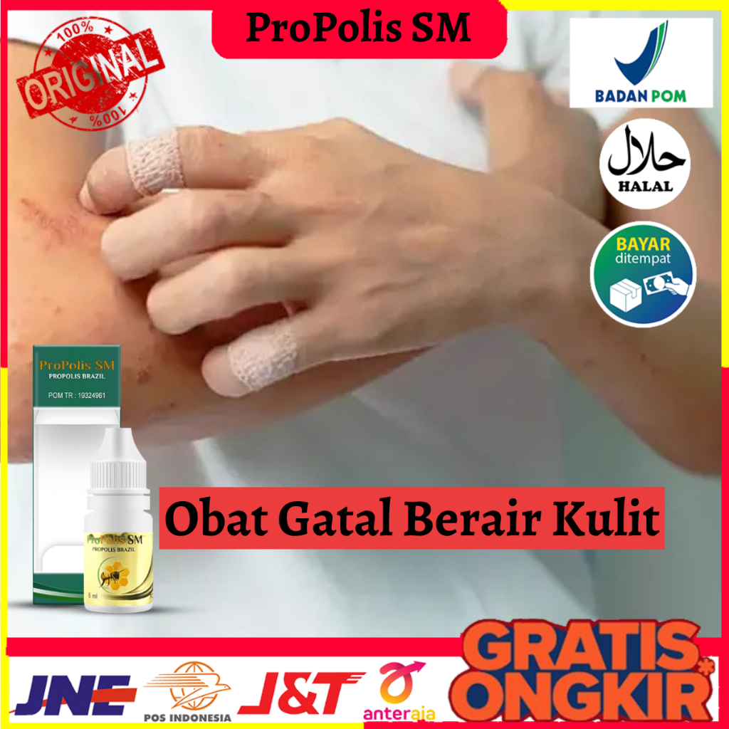 Jual Obat Gatal Berair Kulit, Obat Gatal Kulit, Obat Gatal Berair Di ...