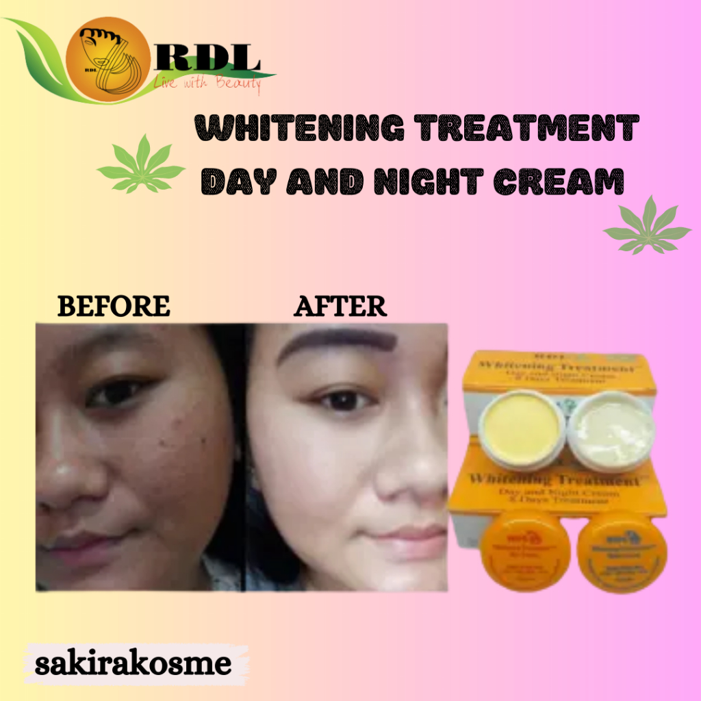 Jual CREAM RDL DAY NIGHT - RDL WHITENING TREATMENT DAY AND NIGHT CREAM ...
