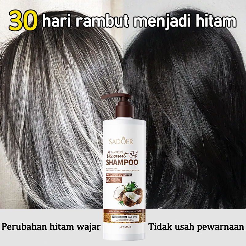 Jual Sampo penghitam rambut uban-Sampo uban-Shampo anti uban 500ML ...