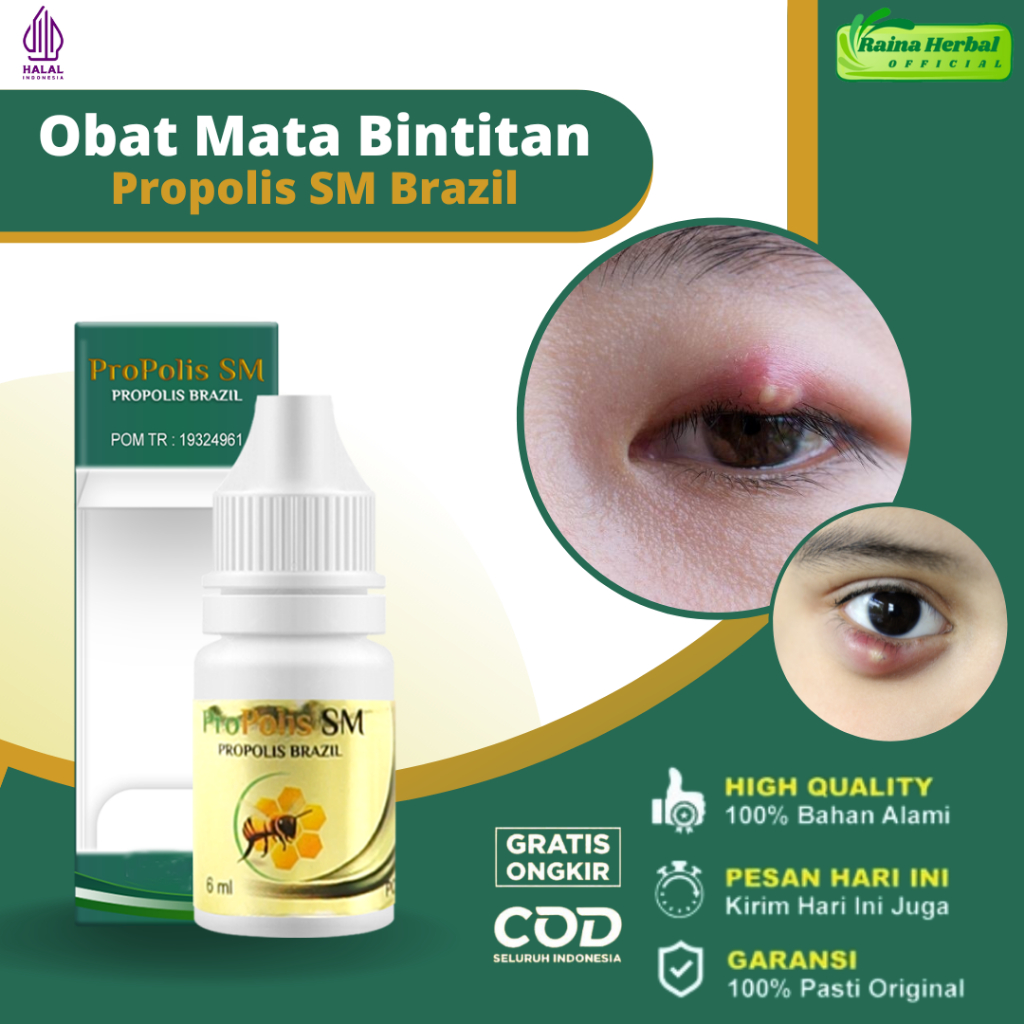 Jual Obat Mata Bintitan Kalazion, Obat Mata Bengkak, Obat Benjolan Di ...