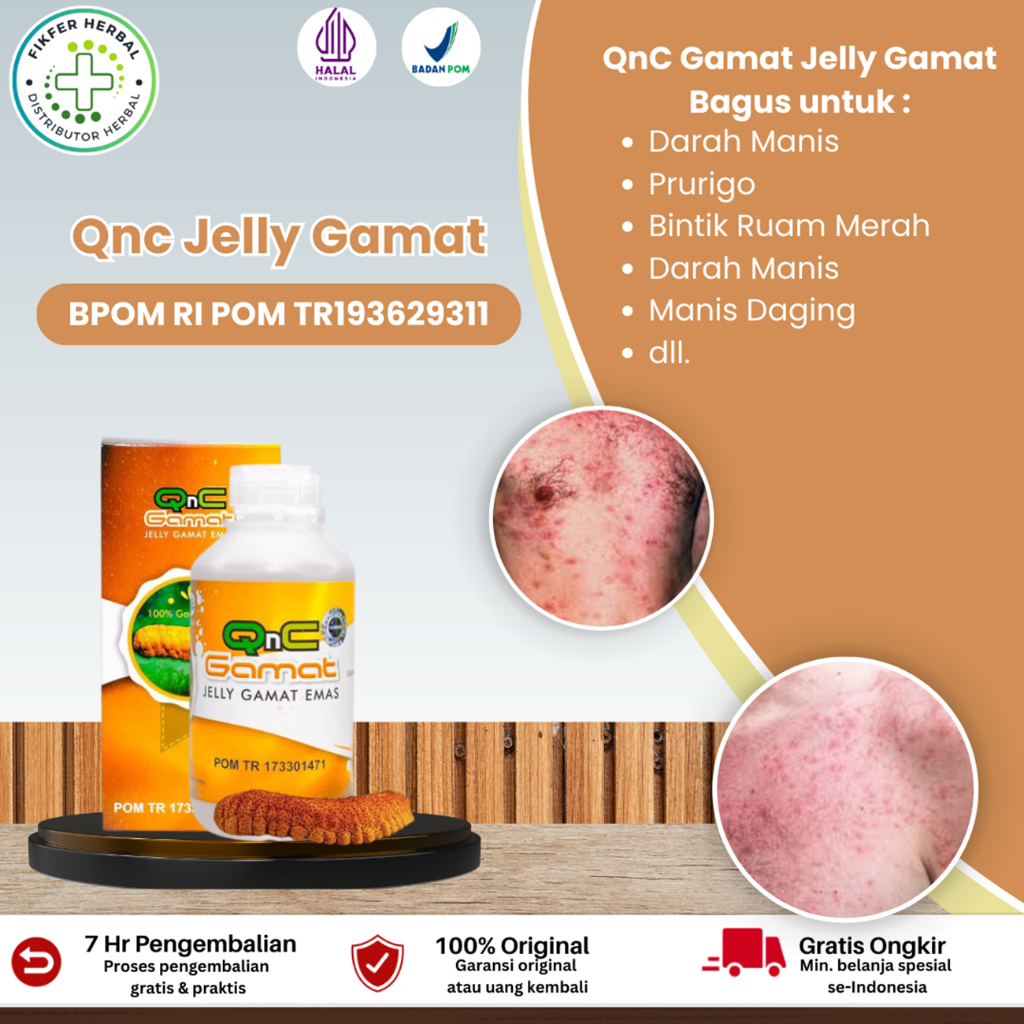 Jual Obat Darah Manis, Prurigo, Bintik Ruam Merah Pada Tubuh ...