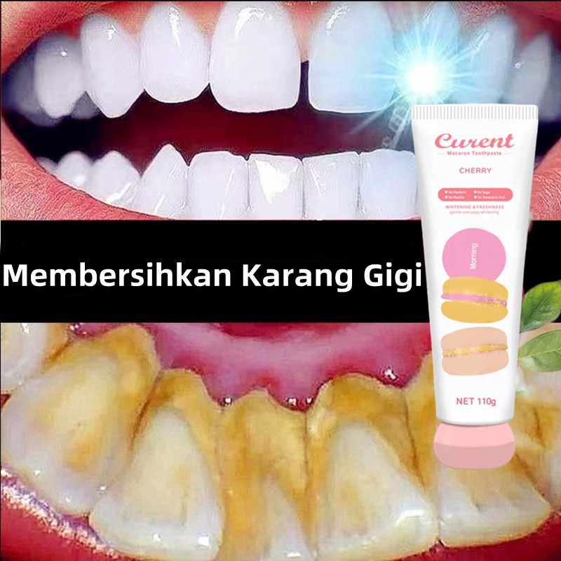 Jual Pasta Gigi Pemutih Gigi Toothpaste Whitening Memutihkan Gigi Dan ...